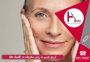 تزریق چربی به روش میکروفت - جوانسازی، بهبود کیفیت پوست با Microfat ...